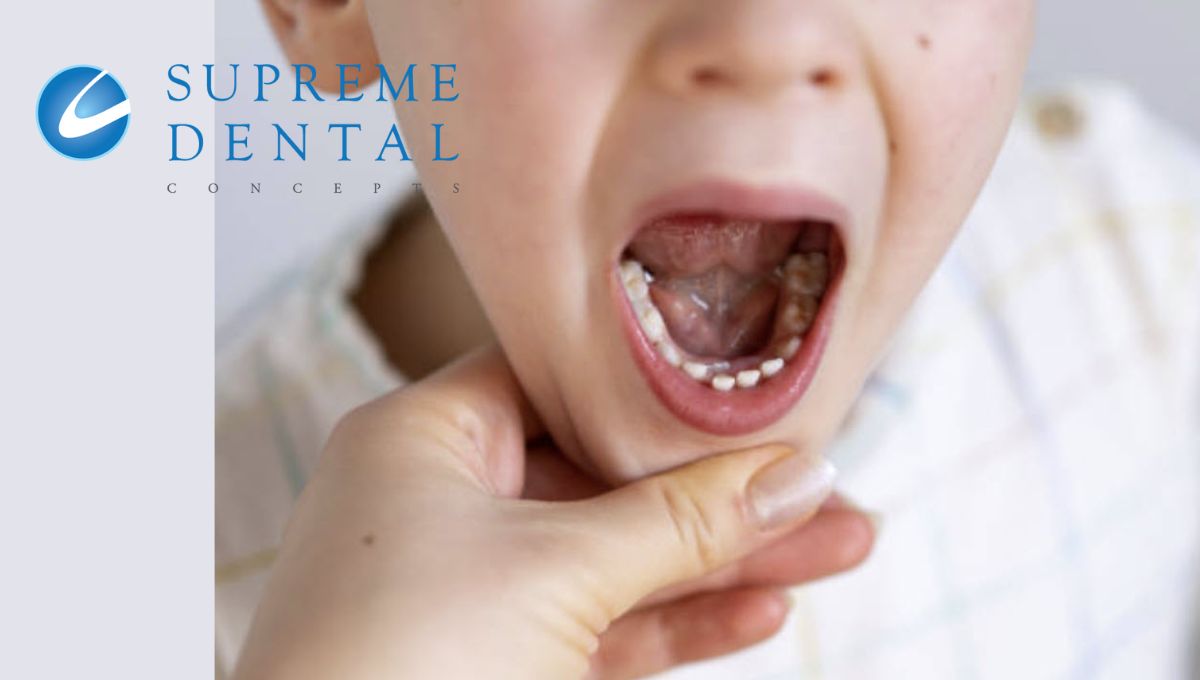 The Mystery of Late Tooth Eruption Unveiled | Supreme Dental Concepts ...